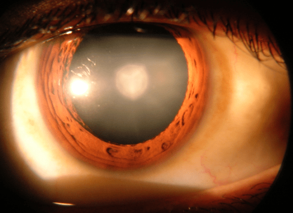 Common Eye Conditions Diagnosed and Managed by Ophthalmologists